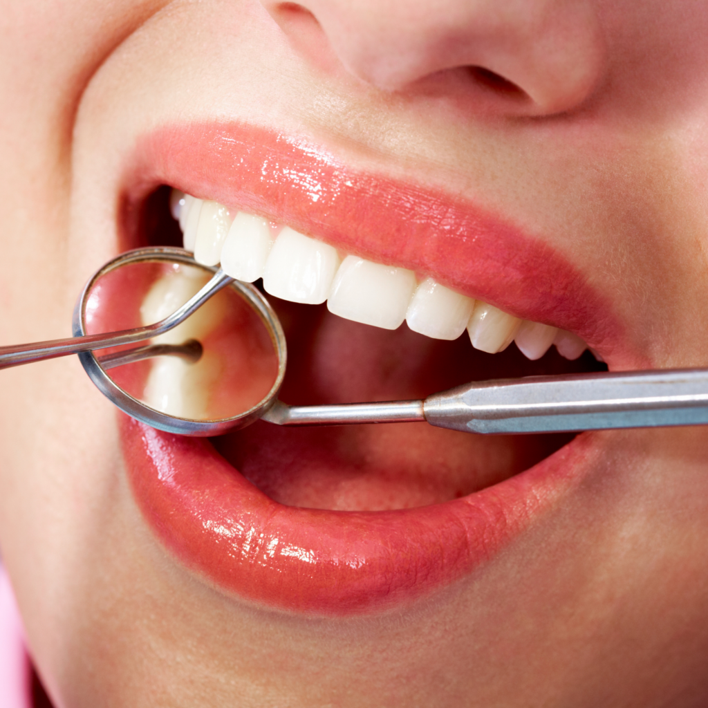 Why do I need my teeth shaved when I get crowns or veneers ...