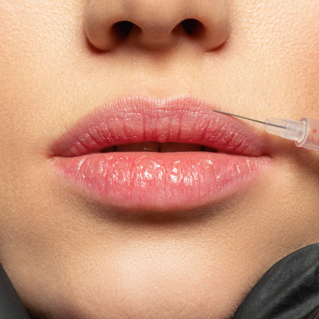 What’s the difference between fillers and Botox? - Duddingston Park